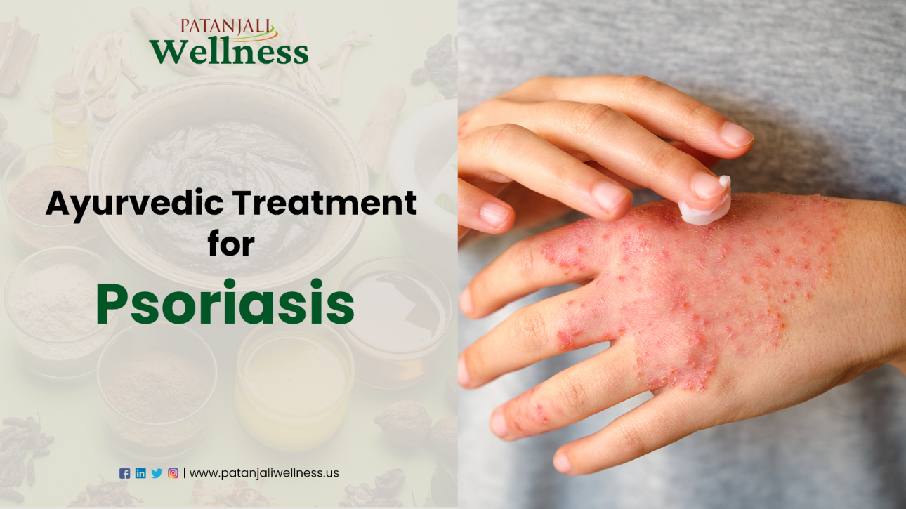 Ayurvedic Treatment for Psoriasis - Patanjali Wellness Center